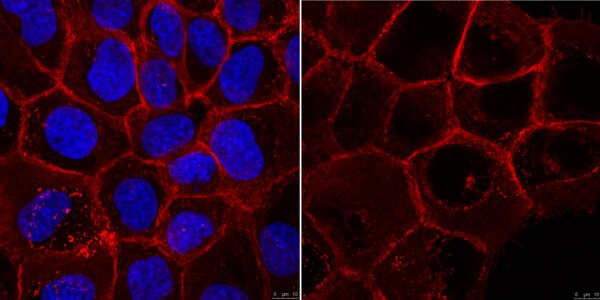 Anti-Integrin beta1 (CD29) Antibody, clone mAb13 | MABT821